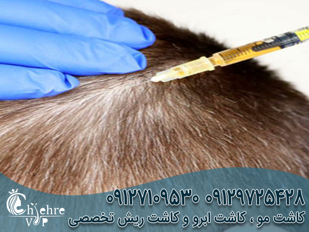 فولیکول مو چیست و چه عملکردی دارد؟ تقویت فولیکول مو